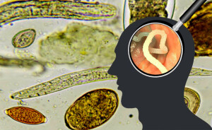 Parasites And Disease - Unariun Wisdom